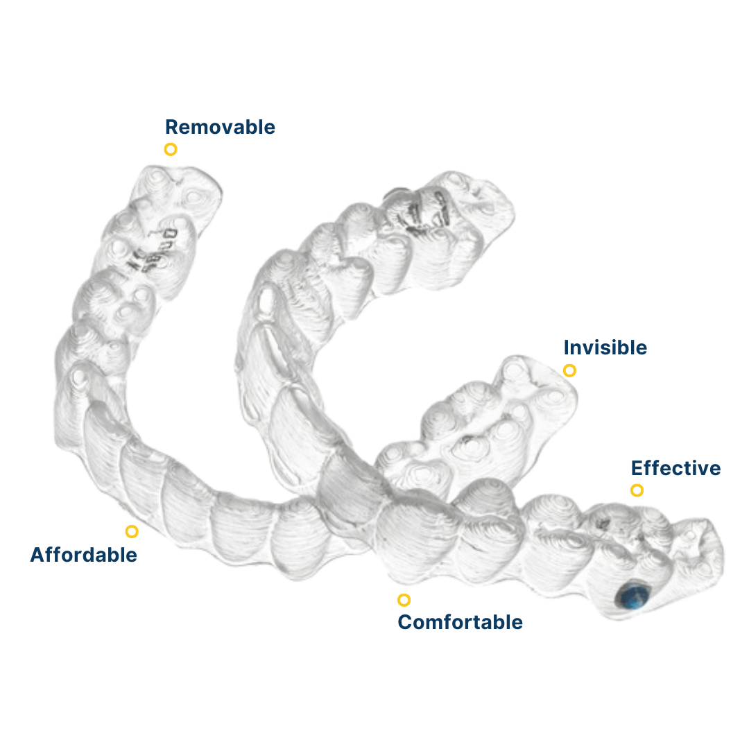 Invisalign Surrey | Straighten Teeth Discreetly at Beyond Braces