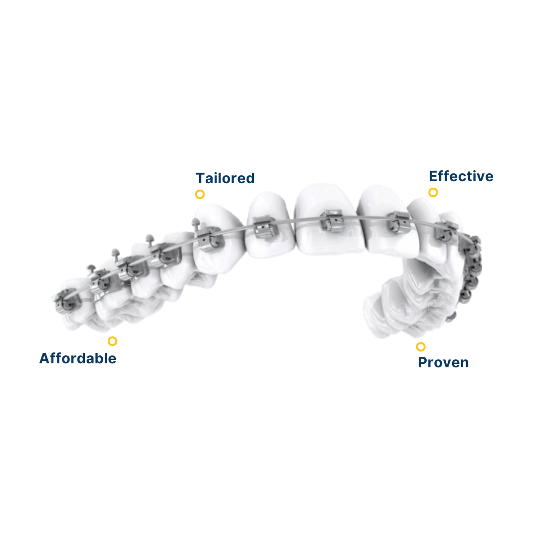 Beyond Braces: Surrey's Orthodontist for Braces | 20+ Years
